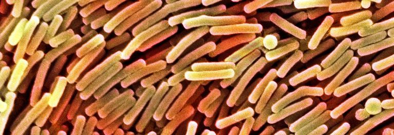 C. Diff: Deadly Infection on the Rise - Consumer Reports