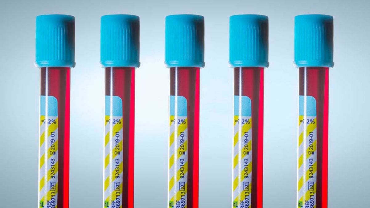 Pros and Cons of 18 Medical Tests - Consumer Reports