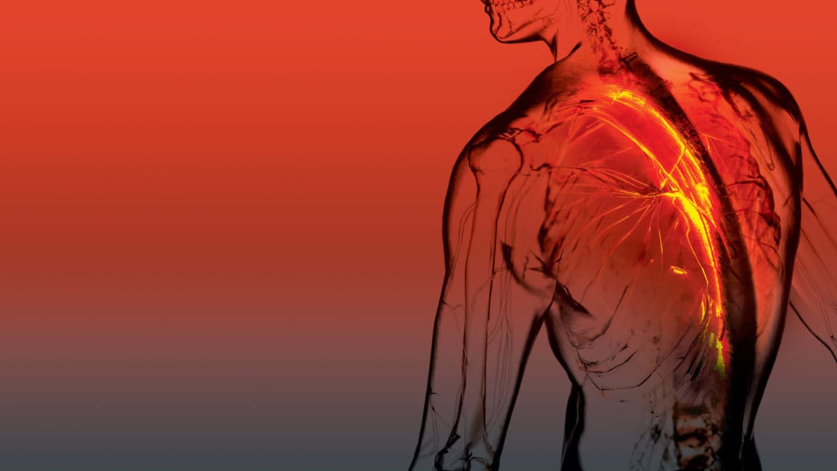 Pain Relief | How to Get Relief from Chronic Pain - Consumer Reports