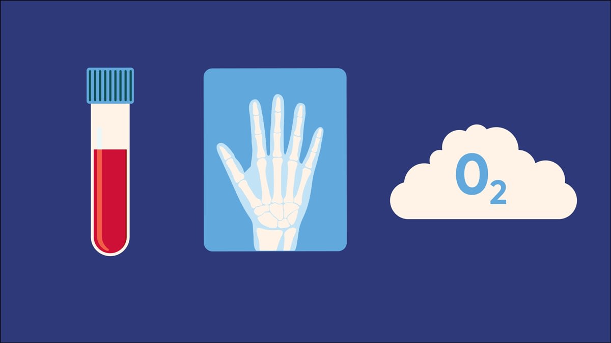 4 Medical Tests Worth Asking About - Consumer Reports