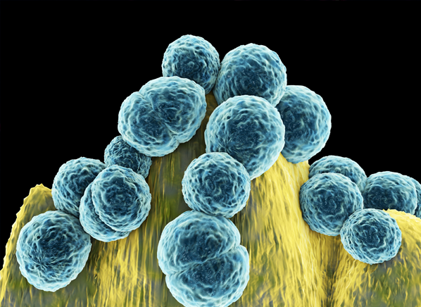 Deadly Hospital Infections Are Still Too Common - Consumer Reports News