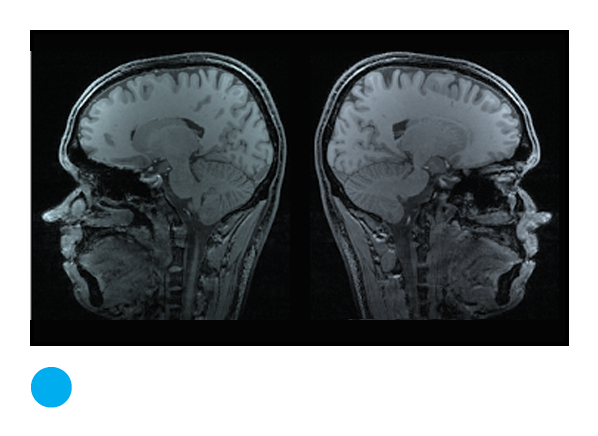 Dangers of CT Scans and X-Rays - Consumer Reports